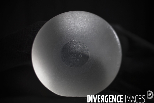 Prothèse mamaire PIP par Patrick GHERDOUSSI - Photographie PGH0458017 ...